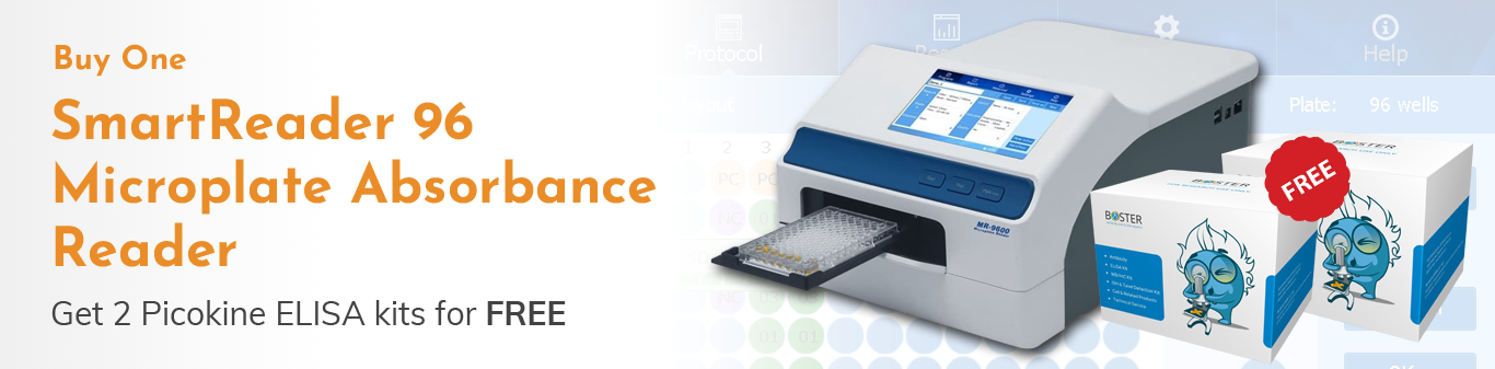 SmartReader 96 Microplate Absorbance Reader Promotion | Boster Bio