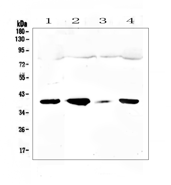 uPA Receptor/PLAUR Antibody