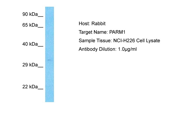 Prostate Androgen-Regulated Mucin-Like Protein 1 Polyclonal Antibodies ...