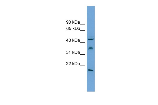 VH3 Antibodies | AntibodyResource.com