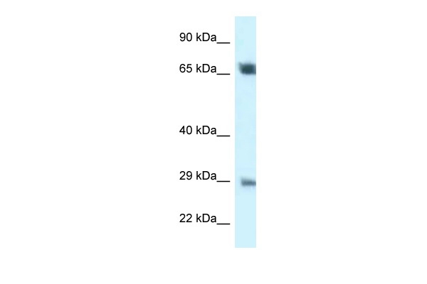 SPC25 Component Of NDC80 Kinetochore Complex Antibodies ...