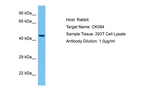 Spindlin Interactor And Repressor Of Chromatin Binding Antibodies ...