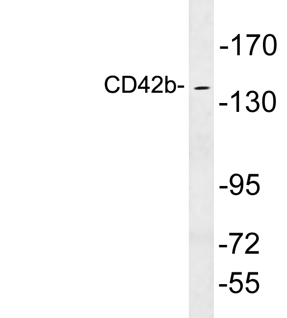 Anti-GP1BA Antibody