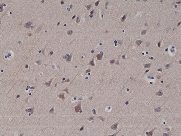 LC3B Rabbit Monoclonal Antibody , Clone#RM293