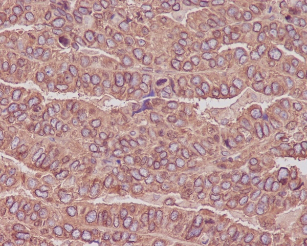 beta III Tubulin Rabbit Monoclonal Antibody