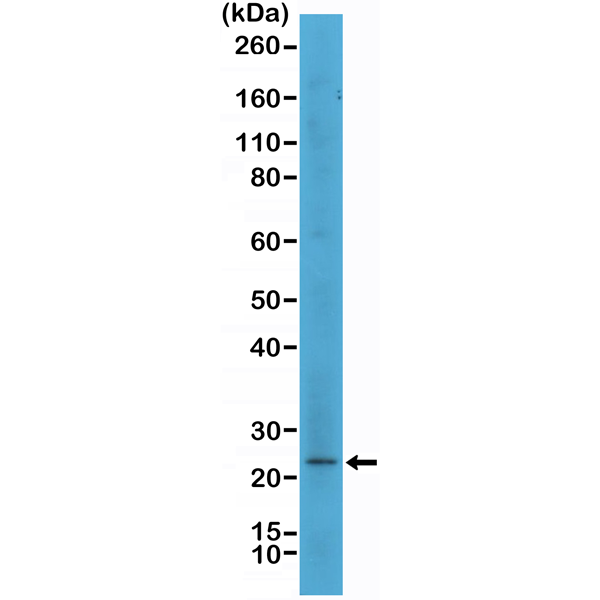 Anti-GM2/GD2 synthase B4GALNT1 Antibody