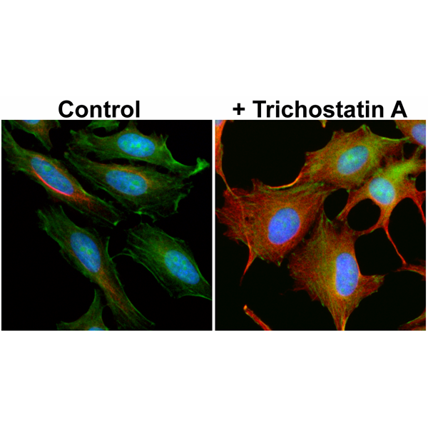 Acetyl-alpha-Tubulin TUBA1B Rabbit Monoclonal Antibody, Clone#RM318