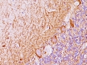 NF200 Antibodies | AntibodyResource.com