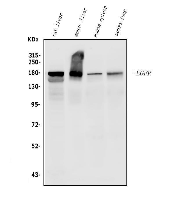EGFR Antibodies for Immunohistochemistry frozen - Antibody Resource Page