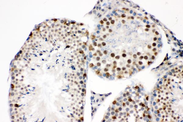 Anti-SOX9 Antibody Picoband™ | Bosterbio