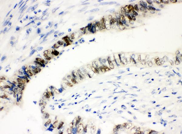 Anti-SOX9 Antibody Picoband™ | Bosterbio