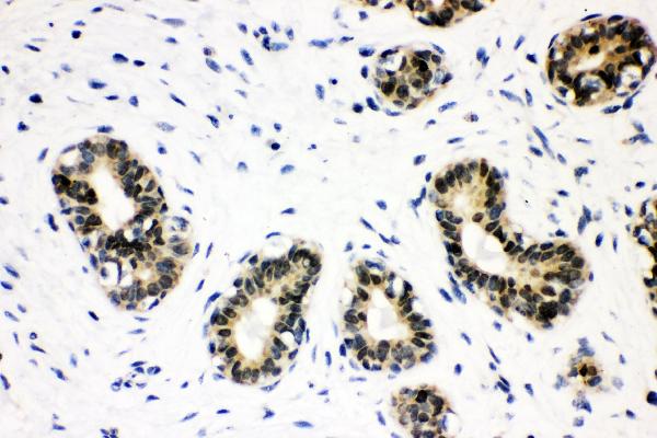 Anti-SOX9 Antibody Picoband™ | Bosterbio