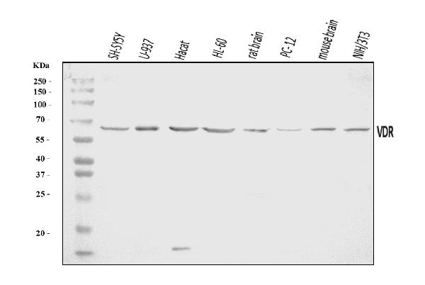 Vitamin D Receptor/VDR Antibody