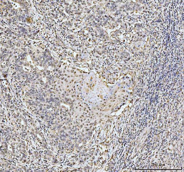 Nucleolin/NCL Antibody