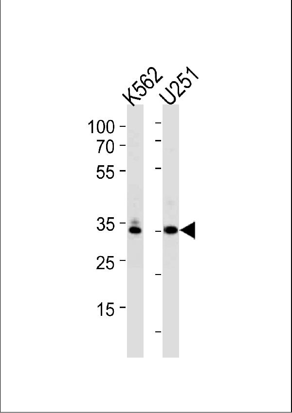 Anti-TBP Antibody (Center) | Boster