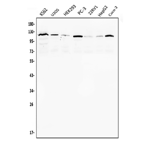 Anti-Androgen Receptor/AR Antibody Picoband™ | Bosterbio