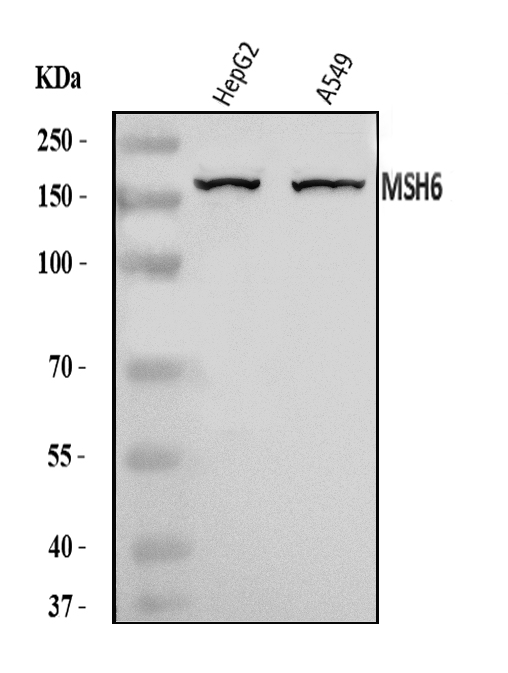 MSH6 Antibody