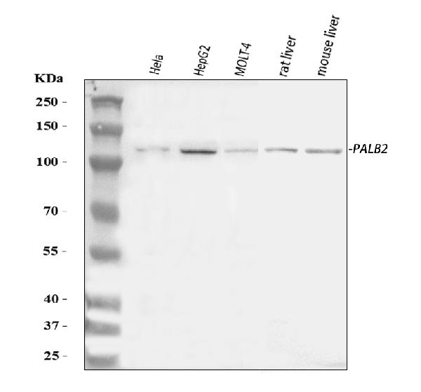 PALB2 Antibody