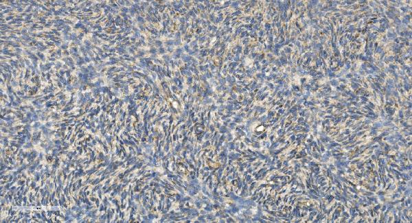 Anti-FLCN Antibody Picoband™ | Bosterbio
