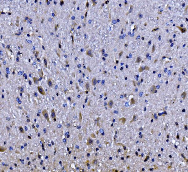 EEF2/Elongation factor 2 Antibody