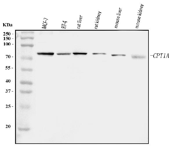 CPT1A Antibody