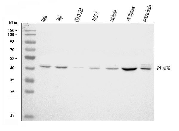 uPA Receptor/U-PAR/PLAUR Antibody