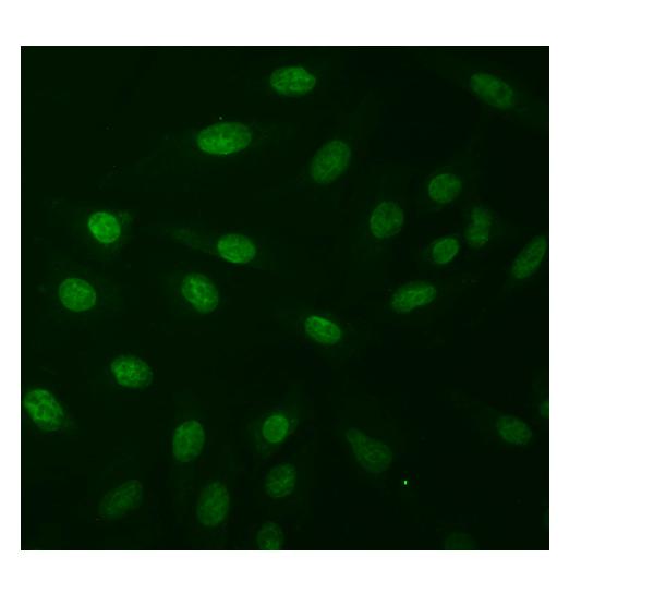 Natriuretic Peptide Receptor A/GC-A/NPR1 Antibody