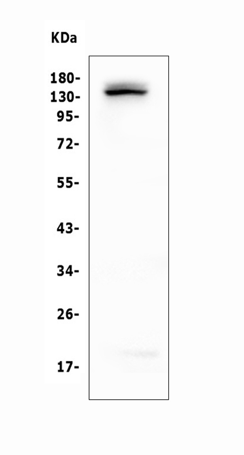 Anti-LATS1 Antibody Picoband™ | Bosterbio