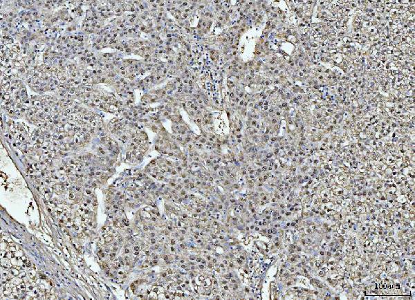 liver Arginase/ARG1 Antibody