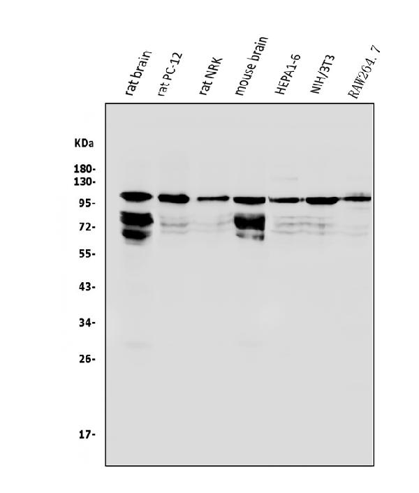 Anti-HGS Antibody Picoband™ | Bosterbio