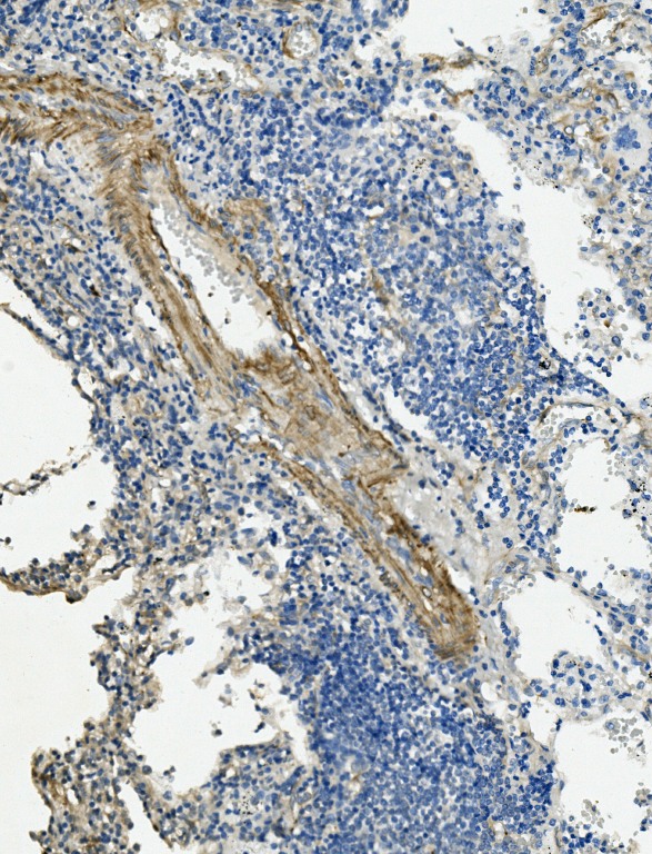 Vinculin/VCL Antibody A01207-1