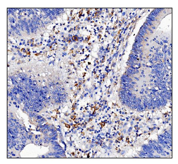 Anti-CD16/FCGR3A Antibody Picoband™ | Bosterbio