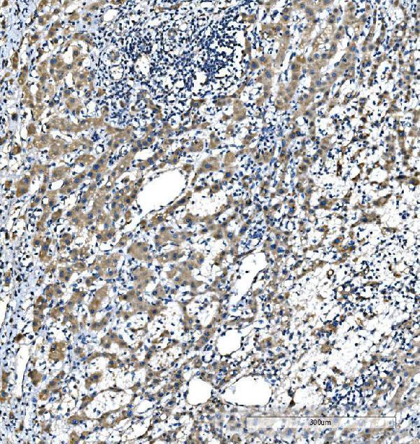 Anti-CYP7A1 Antibody Picoband™| Bosterbio