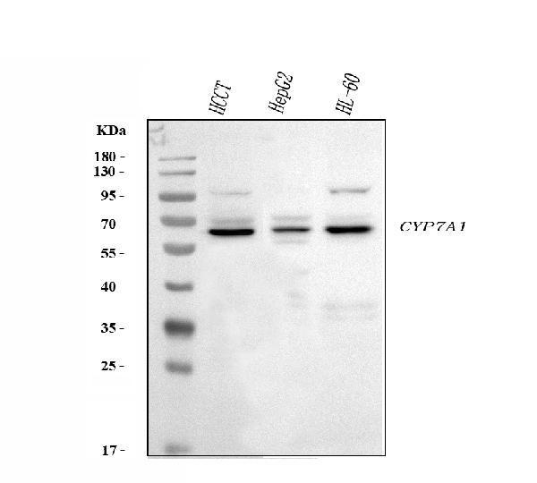 Anti-CYP7A1 Antibody Picoband™| Bosterbio