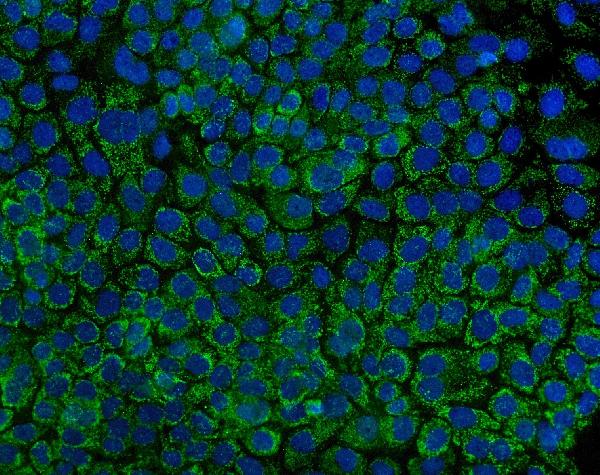 Tryptophan Hydroxylase/TPH1 Antibody