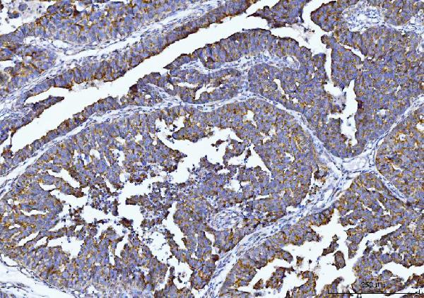 Tryptophan Hydroxylase/TPH1 Antibody