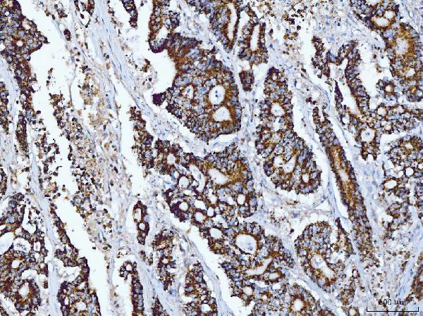 Tryptophan Hydroxylase/TPH1 Antibody
