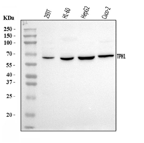 Tryptophan Hydroxylase/TPH1 Antibody