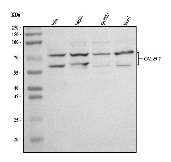 GLB1/Beta-galactosidase Antibody A01829-2