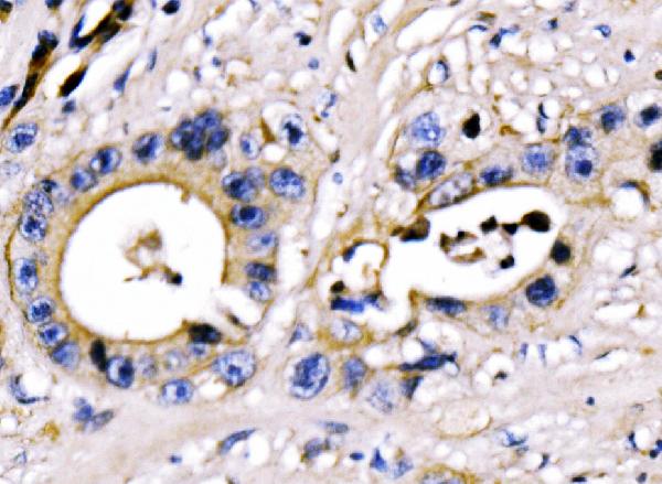 PAR-3/PARD3 Antibody