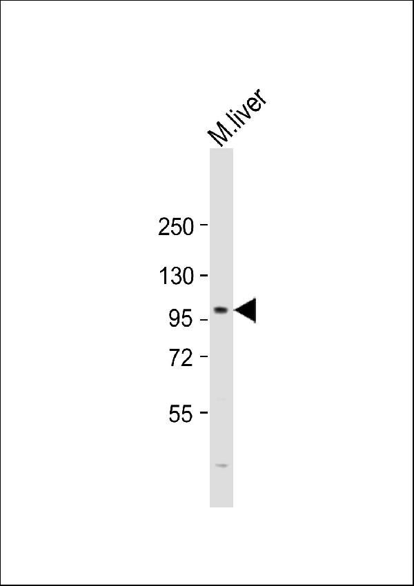 PROX1/Prospero homeobox protein 1 Antibody (PA2229)