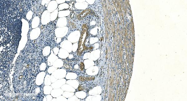H Cadherin/CDH13 Antibody