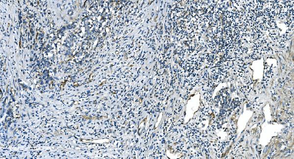 H Cadherin/CDH13 Antibody