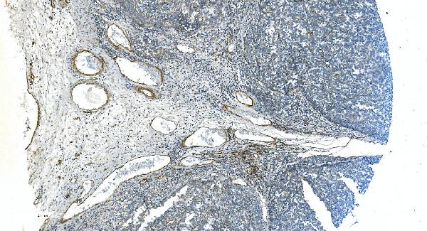 H Cadherin/CDH13 Antibody