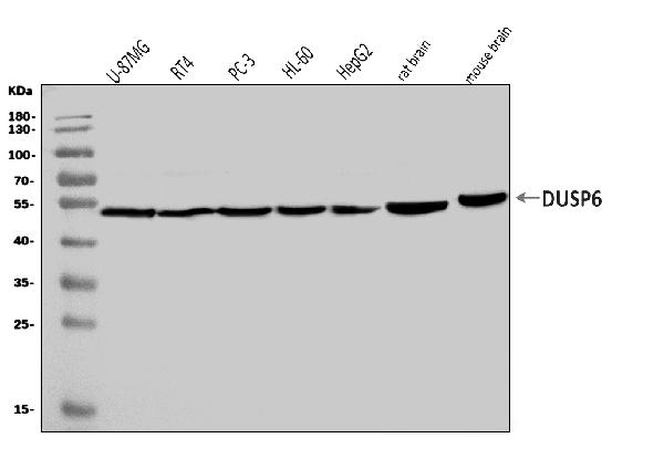 Anti-DUSP6 Antibody Picoband™| Bosterbio