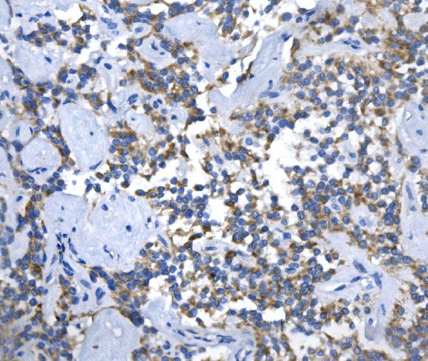 Anti-ASS1 Antibody Picoband™ | Bosterbio