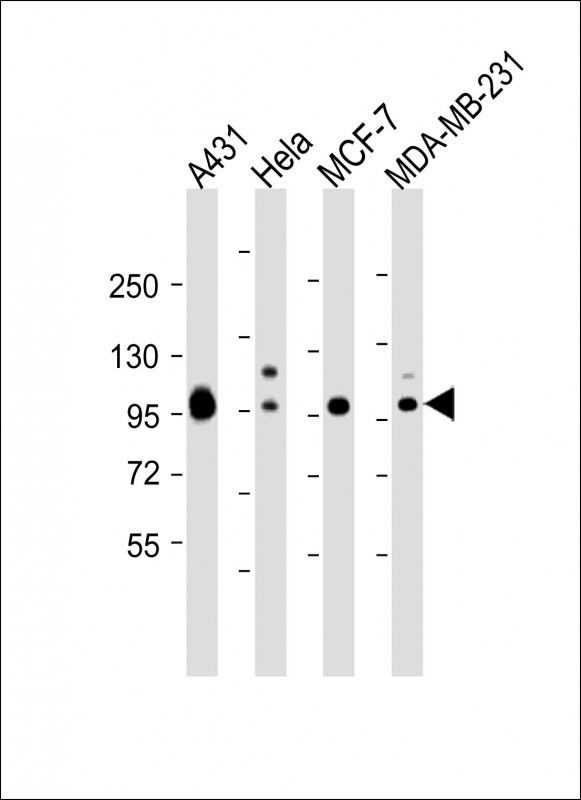 delta 1 Catenin/CAS/CTNND1 Antibody