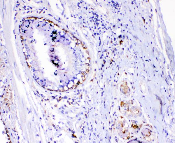 TL1A/TNFSF15 Antibody