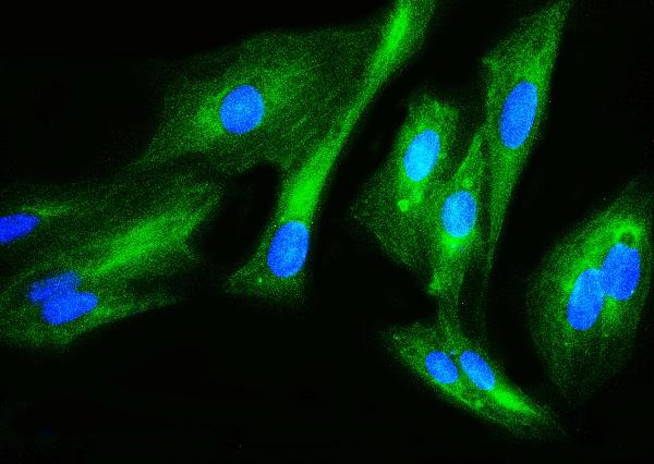 Filamin B/FLNB Antibody