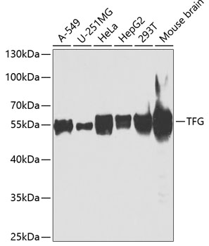 Anti-Protein TFG TFG Antibody A02870-1